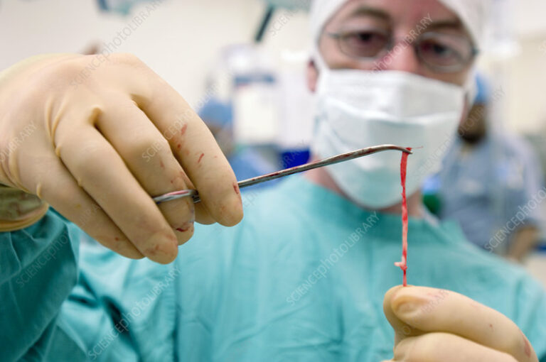 How Vascular Surgeons Help In The Management Of Varicose Veins - Ultra ...